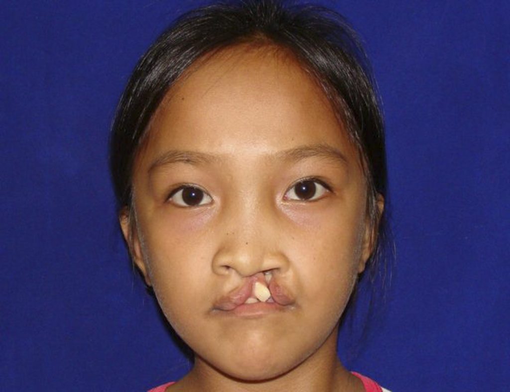 The Philippines: Smokey Mountain photos – one smile at a time
